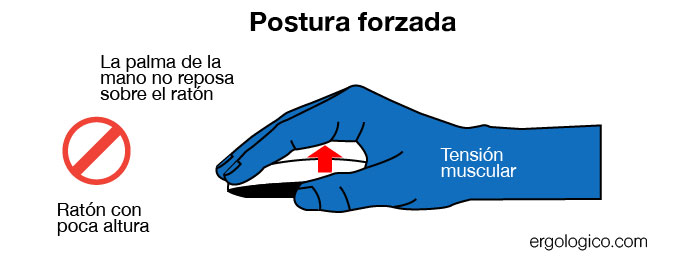 Campaña de prevención del Sindrome de Tunel Carpiano